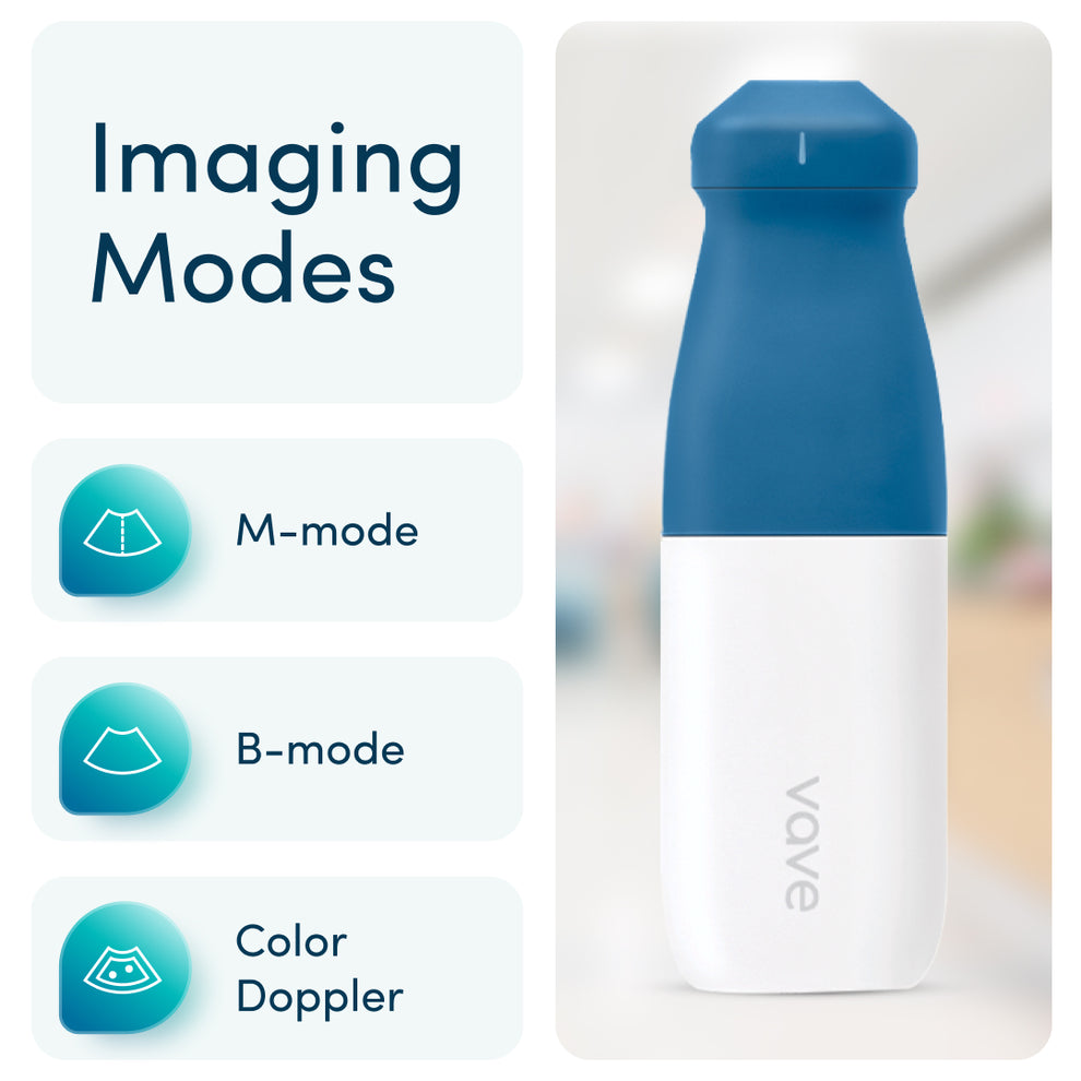 Vave Phased-Array Wireless Ultrasound – Vave Health