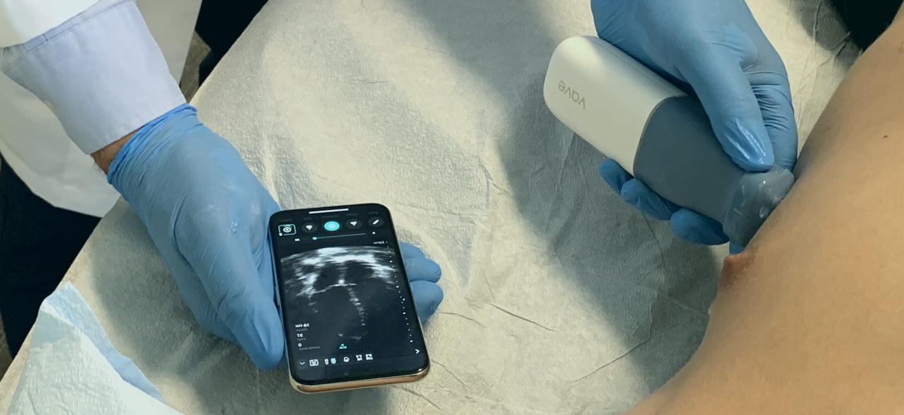 Vave Phased Probe | Deep POCUS Imaging - Vave Health